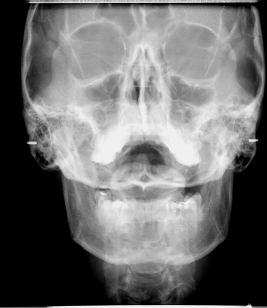 Badania - Pracownie Tomografii i RTG Zębów DENTIDIAG