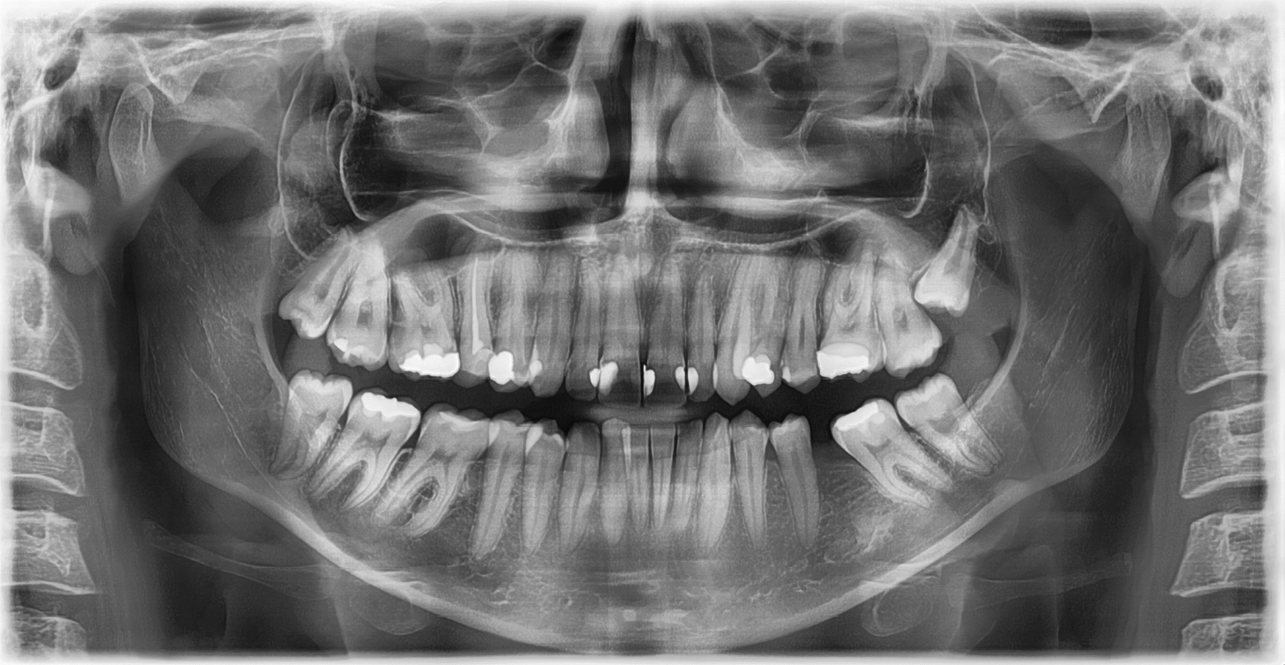 Badania - Pracownie Tomografii i RTG Zębów DENTIDIAG